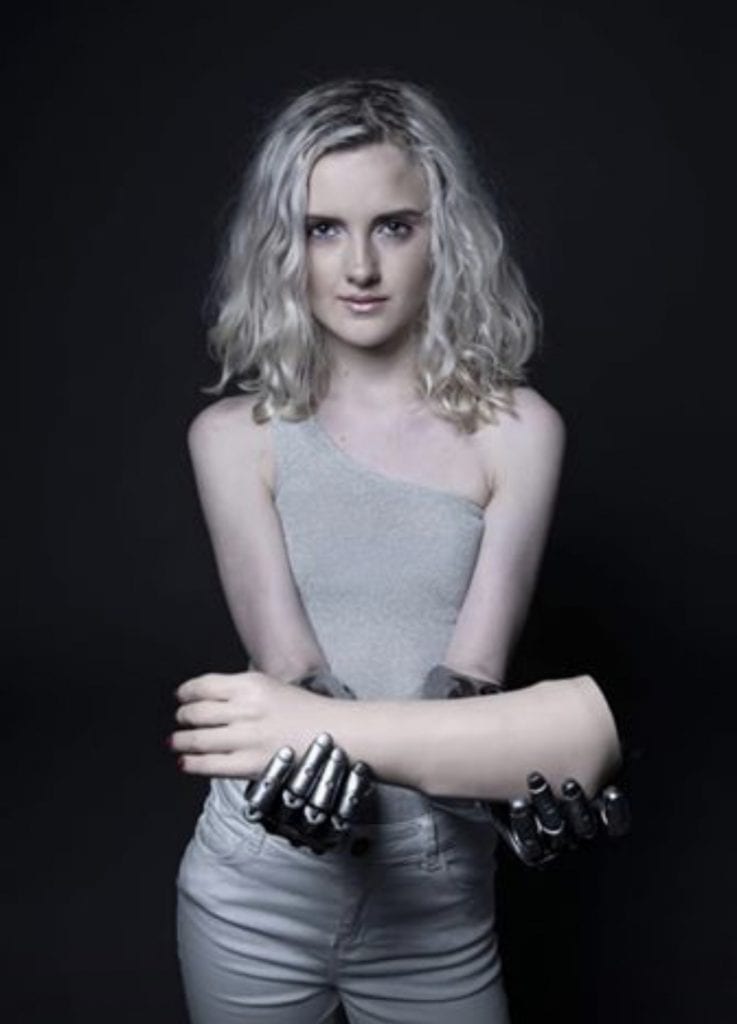 "Bionic Girl" Tilly Lockey, the Real Life Alita - ideaXme